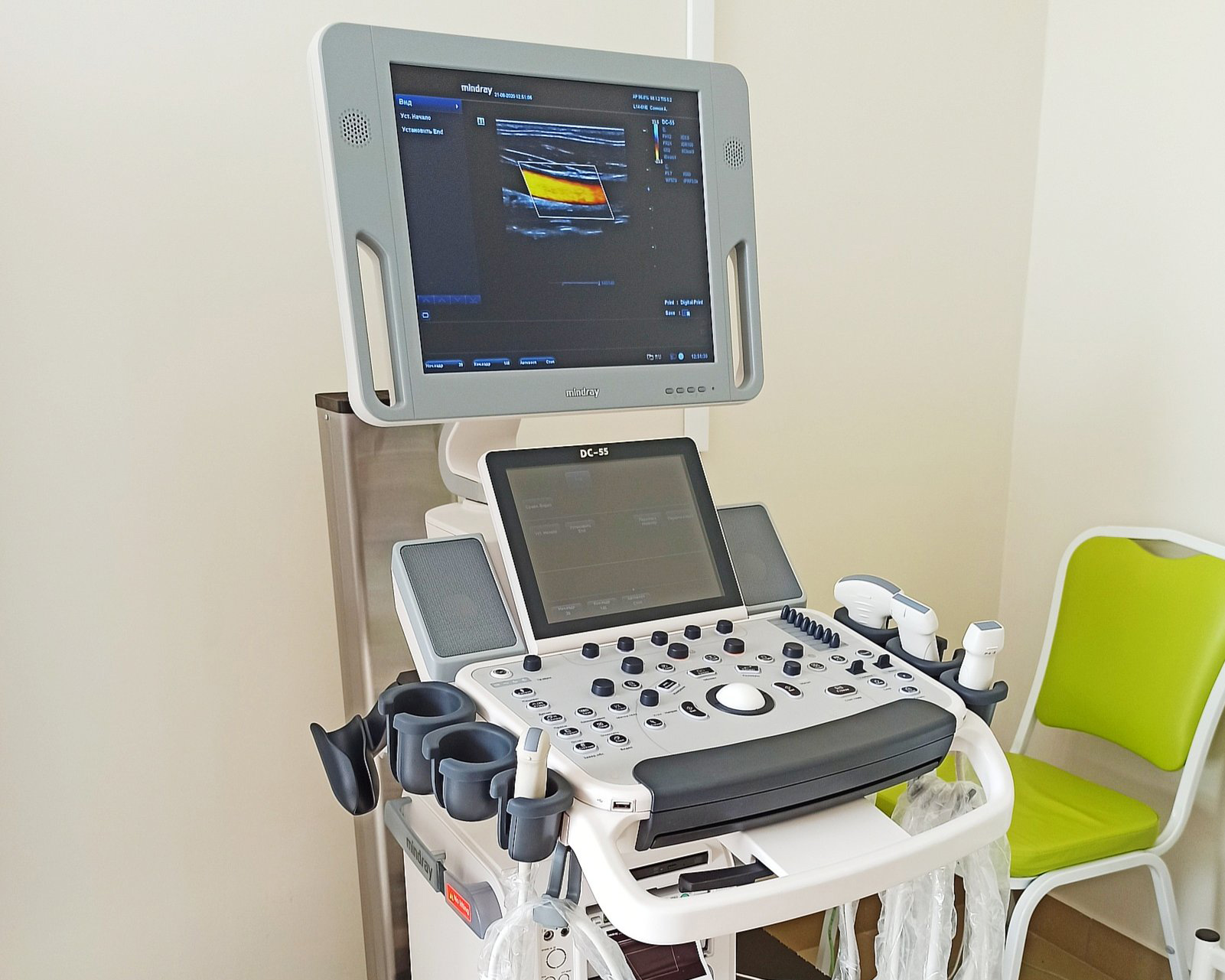 Обзор УЗИ: Mindray DC-55 - Обзоры MEDLIGA