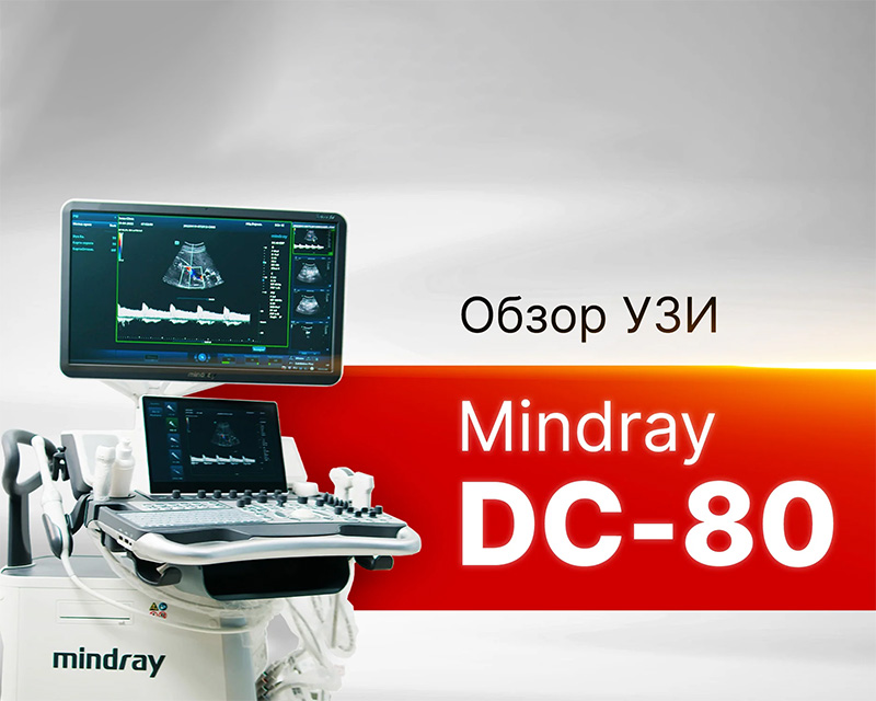 Видеообзор УЗИ аппарата Mindray DC-80 - Обзоры - MEDLIGA