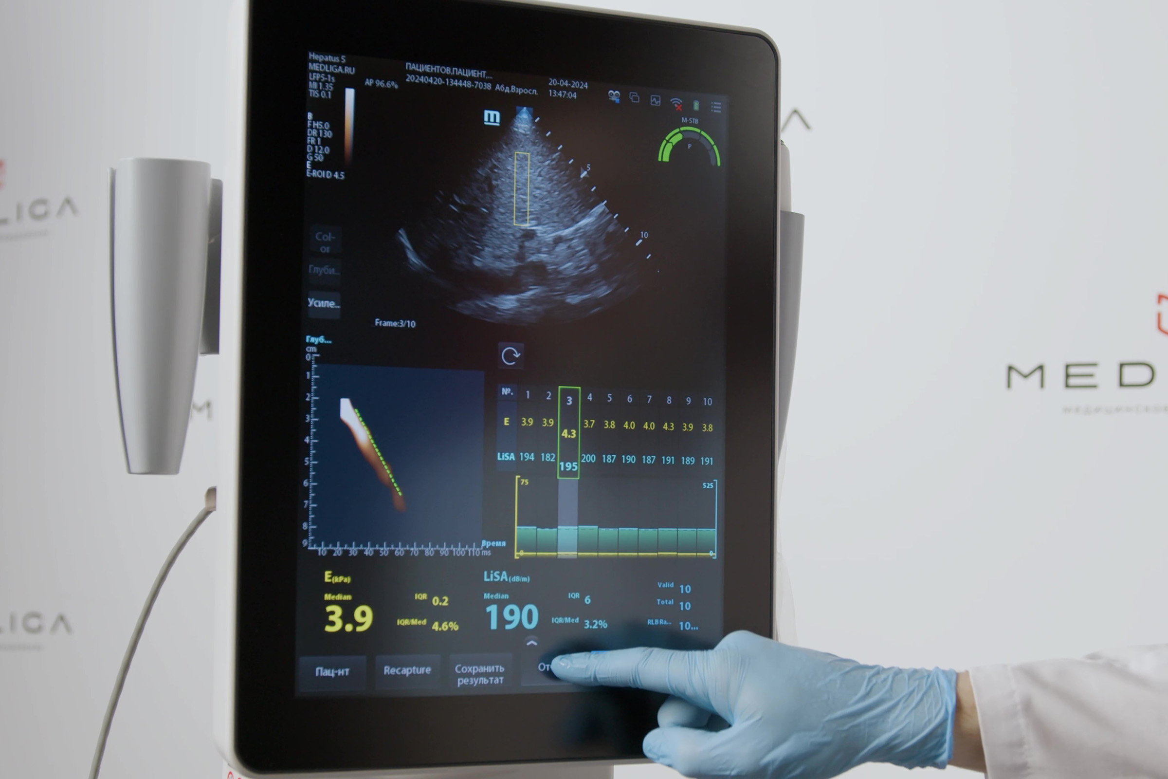 Видеообзор системы фибросканирования печени Mindray Hepatus 5 / Hepatus ...