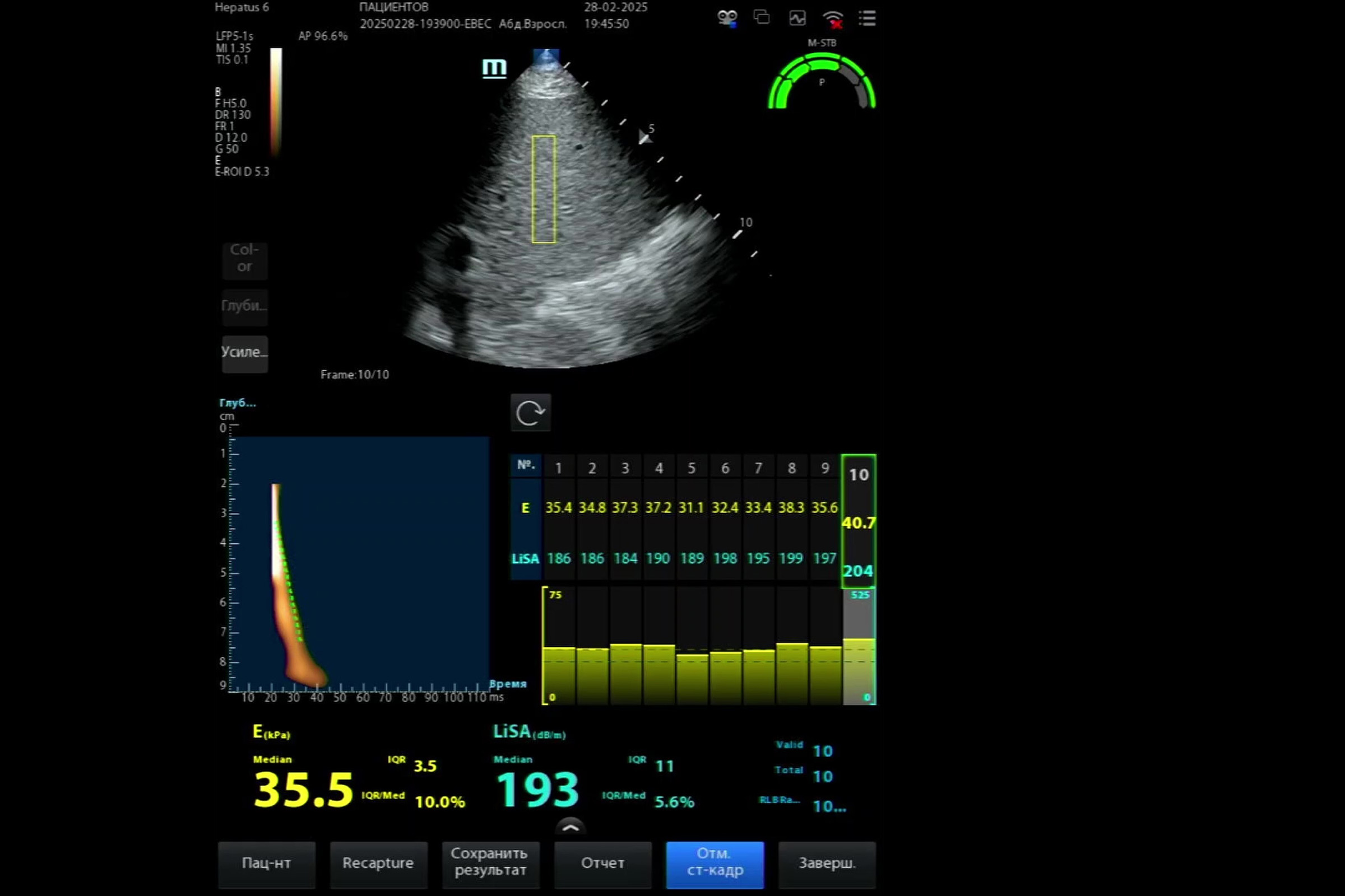 Исследование пациента с хроническим гепатитом на Mindray Hepatus 6 ...