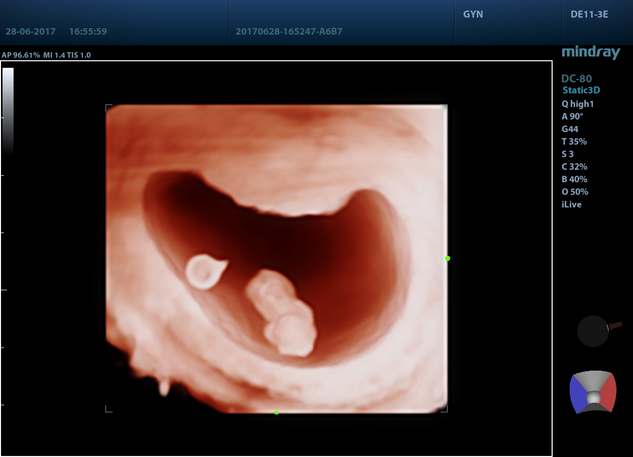УЗИ аппарат Mindray DC-80 - купить в Москве по выгодной цене на MEDLIGA