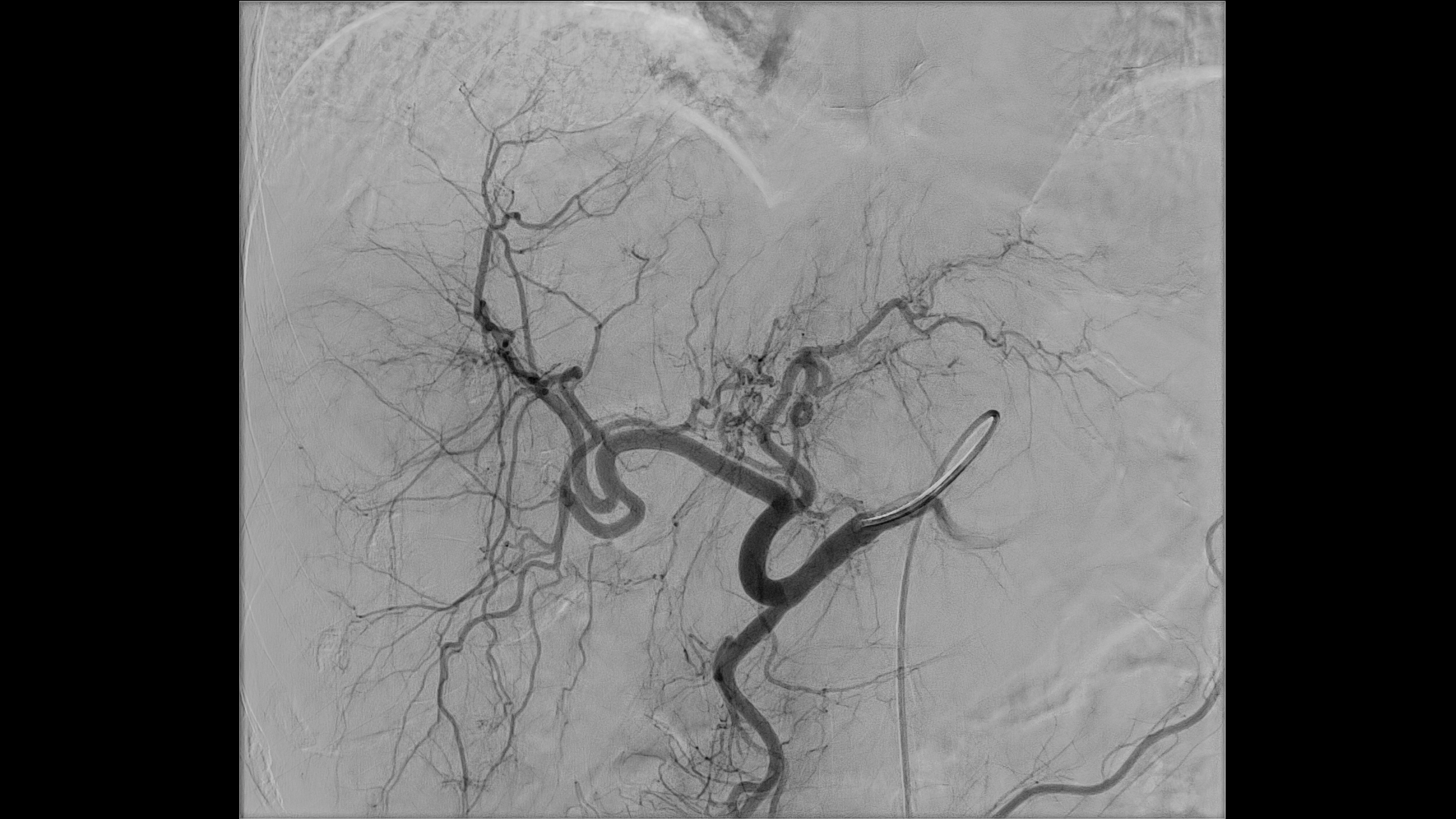 Ангиограф Philips Azurion 5 - купить в Москве по выгодной цене на MEDLIGA