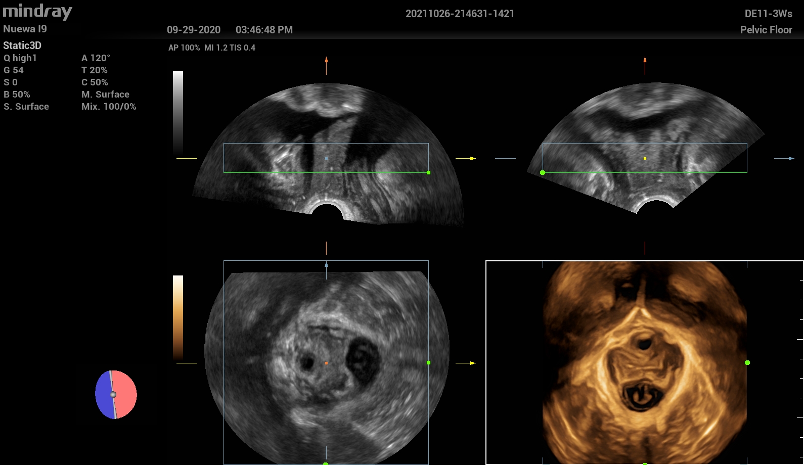 УЗИ аппарат Mindray Imagyn I9 - купить в Москве по выгодной цене на MEDLIGA