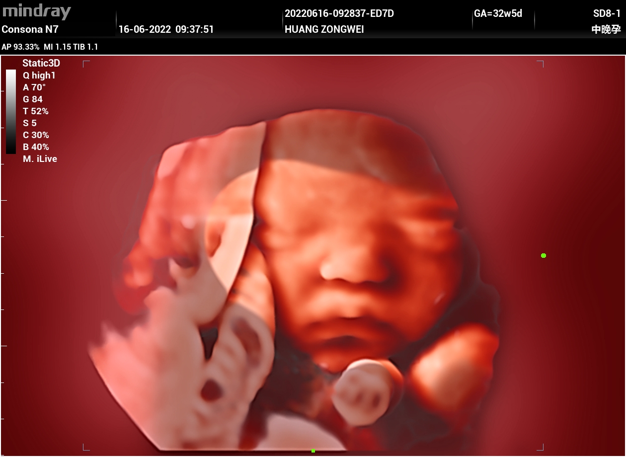 УЗИ аппарат Mindray Consona N7 - купить в Москве по выгодной цене на ...