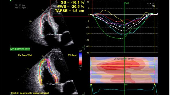 Ультразвуковая диагностическая система GE Healthcare Vivid S70 - купить ...