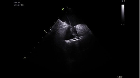 Ультразвуковая диагностическая система GE Healthcare Vivid S70 - купить ...