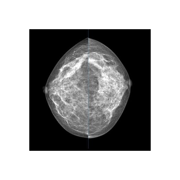 Маммограф GENORAY MX-600 - купить в Москве по выгодной цене на MEDLIGA