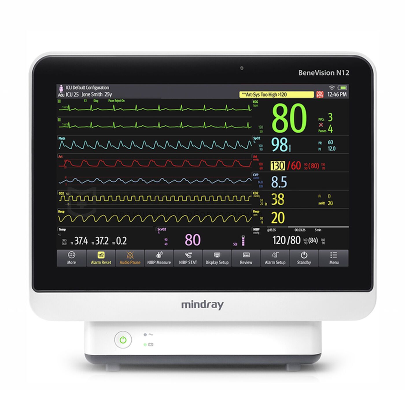Монитор пациента Mindray BeneVision N12 - купить в Москве по выгодной ...