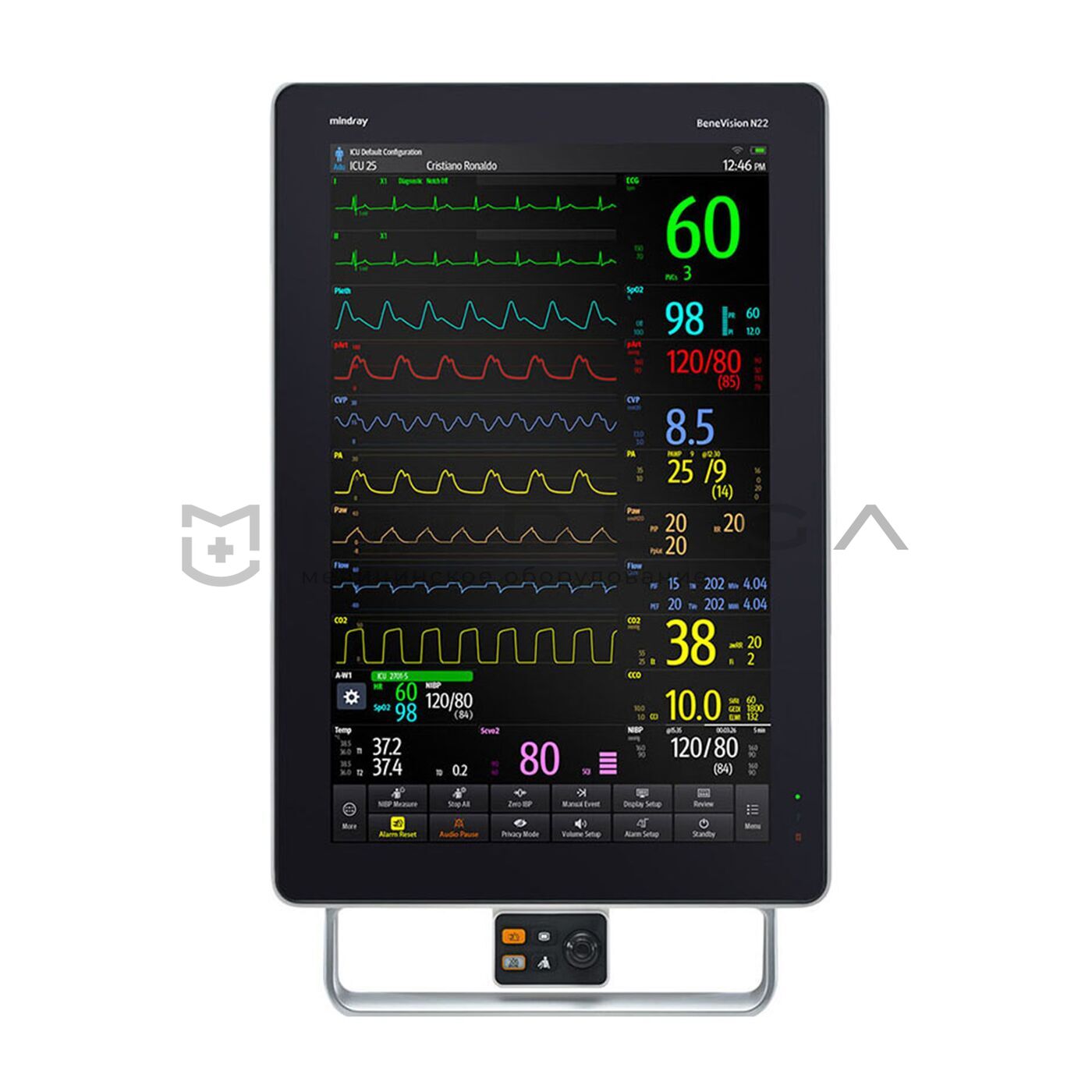 Монитор пациента Mindray BeneVision N22 - купить в Москве по выгодной ...