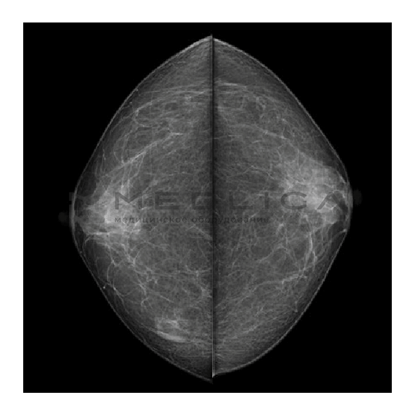 Маммограф GENORAY MX-600 - купить в Москве по выгодной цене на MEDLIGA