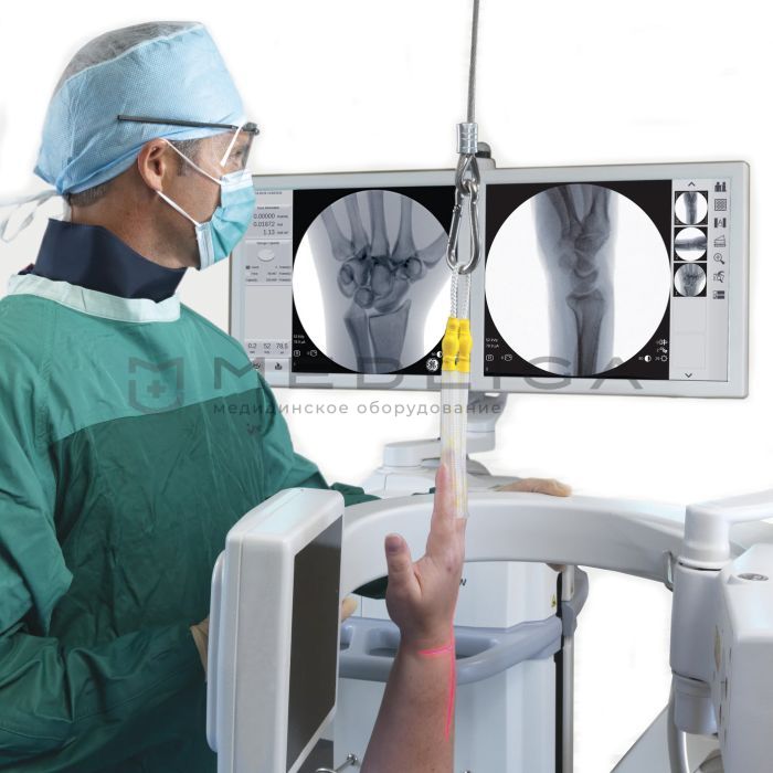 Мобильный рентгеновский аппарат с С-дугой GE OEC Elite MiniView ...