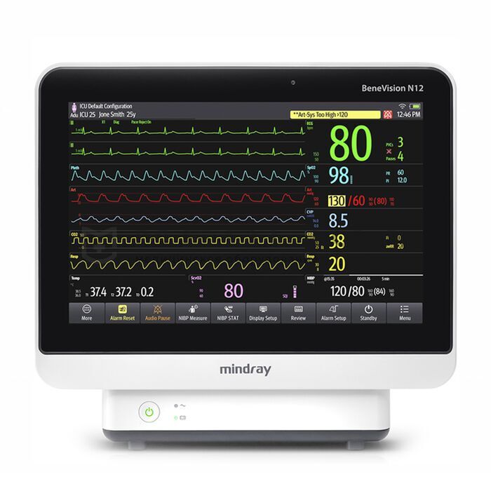 Монитор пациента Mindray BeneVision N12 - купить в Москве по выгодной ...