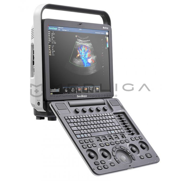 Ультразвуковой аппарат SonoScape S8Exp - купить в Москве по выгодной ...