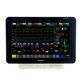 Монитор пациента Philips IntelliVue MX550 - купить в Москве по выгодной ...
